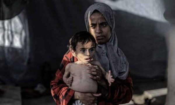 At Least 18 Palestinians Died of Hunger in Gaza on Sunday Amid Israeli ...